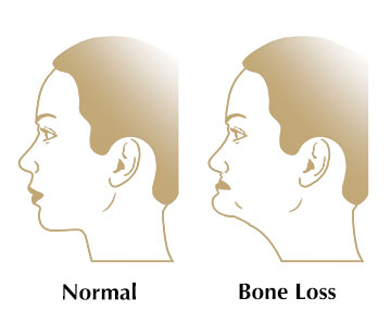 Concave Vs Convex Face