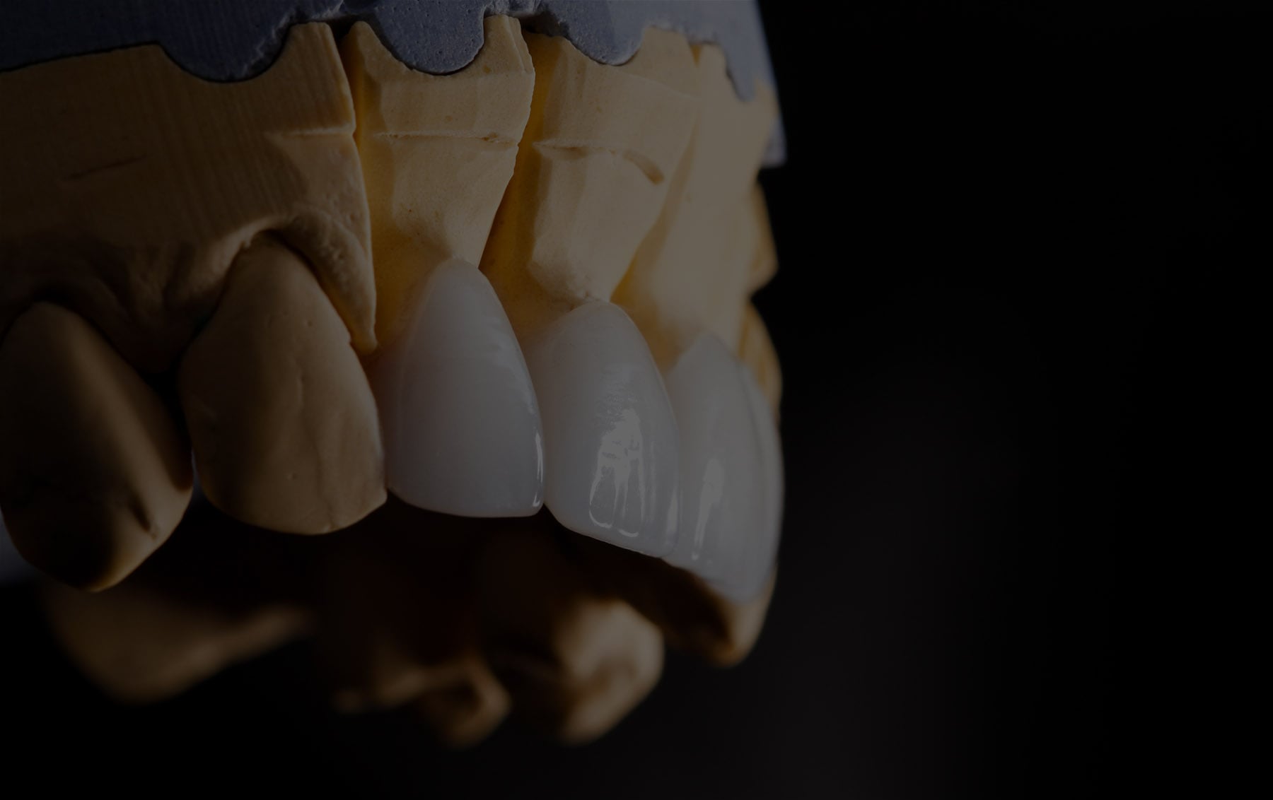 Incorrect Bite - Brushwell Dental & Implants